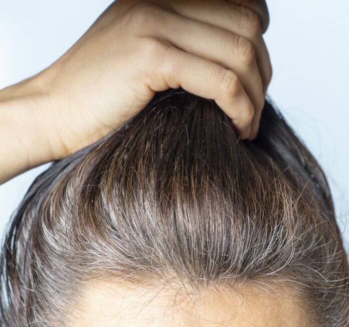 Unlocking Confidence: Taming Resistant Gray with Hair Color - Bolsa de ...